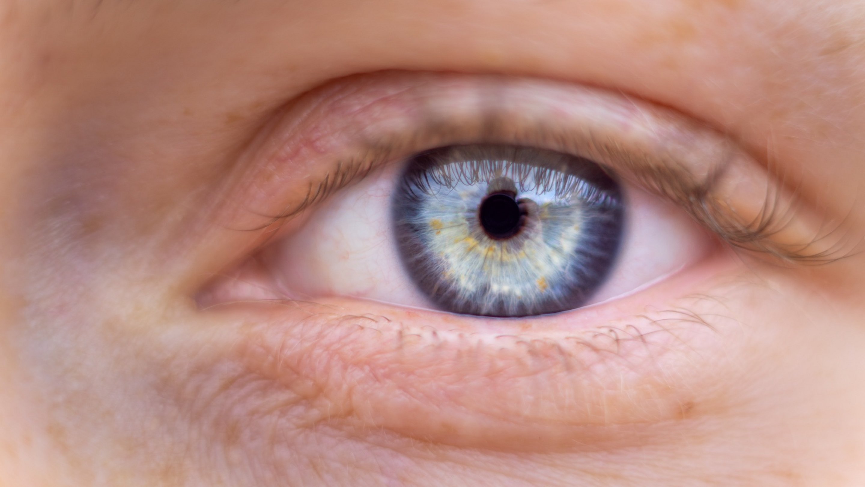 Brushfield-Spots: Was ist das? Wir klären über die Sprenkel auf ...